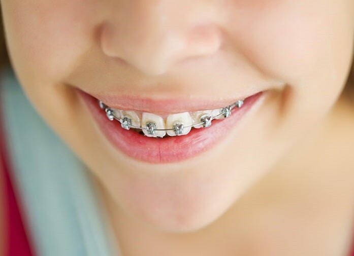 Orthodontie | AÉSIO Santé